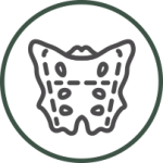 Sacroplasty | Interventional Spine